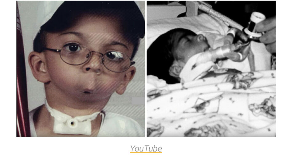 Baby born without jaw wasn't expected to survive, now he inspires a ...