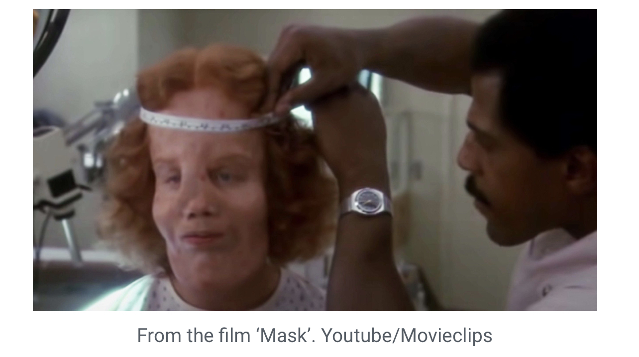 The incredible life of Rocky Dennis - the boy whose rare deformity ...