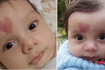 Baby born with 'heart' birthmark became world famous in 2015 - here's ...