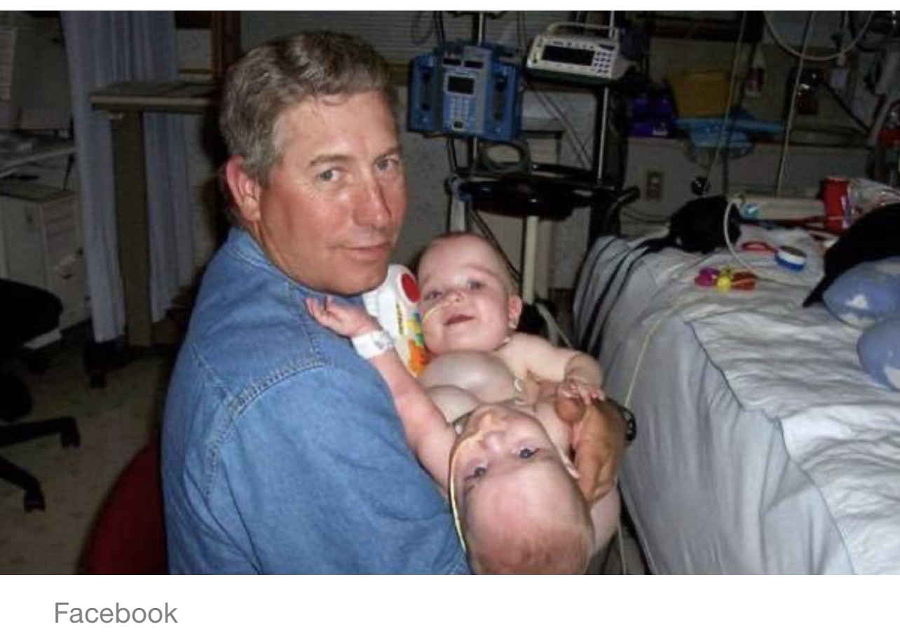 20 years ago, the world’s most unusual babies were born: Today they ...