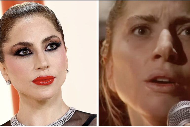 Lady Gaga’s no make-up performance at the Oscars has everyone saying ... Lady Gaga’s no make-up performance at the Oscars has everyone saying ...